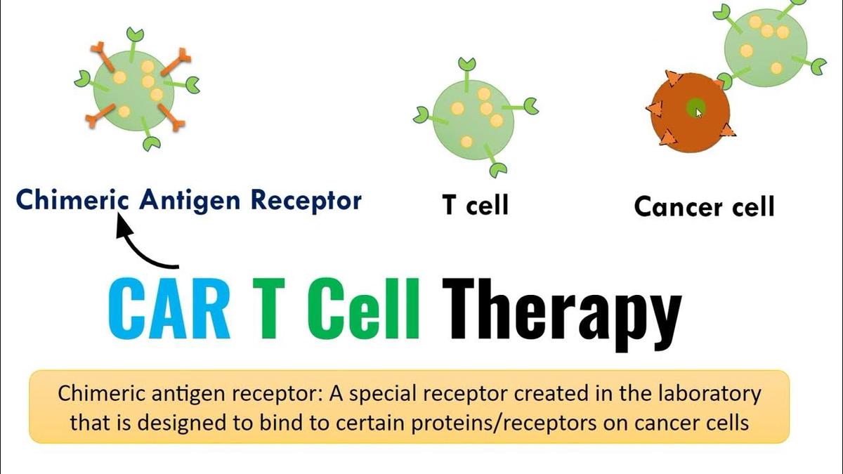 What is CAR T-Cell Therapy? Steps in CAR T-Cell Therapy
